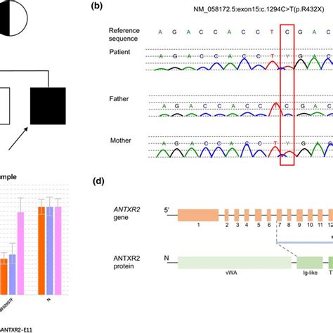 Clinical Presentation And Molecular Characterisation Of Infantile