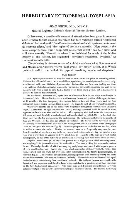 Pdf Hereditary Dysplasia Ectodermal Dysplasia Pdf · Hered