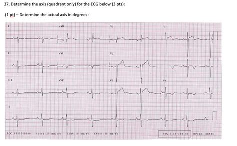 Solved 37 Determine The Axis Quadrant Only For The Ecg