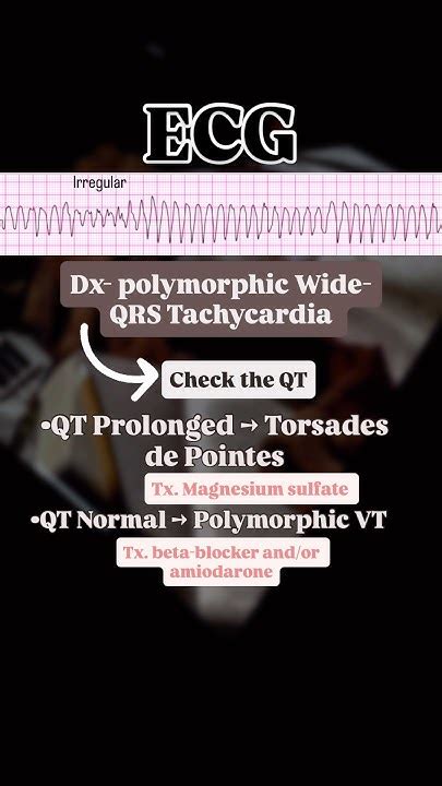 Polymorphic Vt 📸 Studywithme Tips Ecginterpretation Music