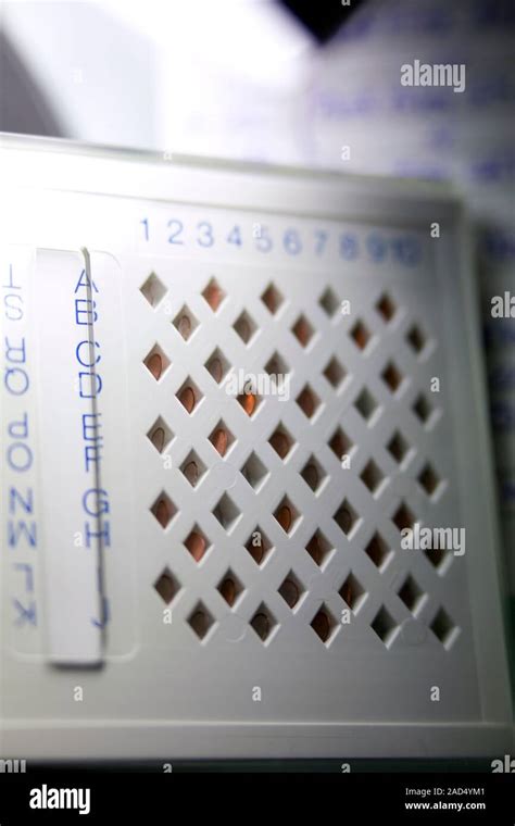 Electron Microscopy Copper Grid In Electron Microscopy Samples Are Often Placed Onto A Copper