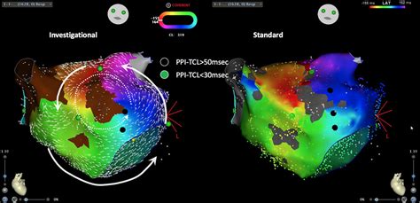 Activation Mapping With Integration Of Vector And Velocity Information