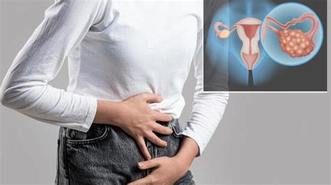 Cáncer De Ovario En Mujeres Jóvenes Causas Y Síntomas Tempranos