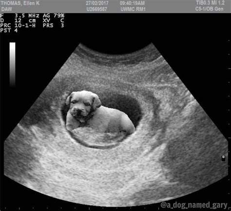 Ultrasound Fetus Sex Gay Porn Sharing