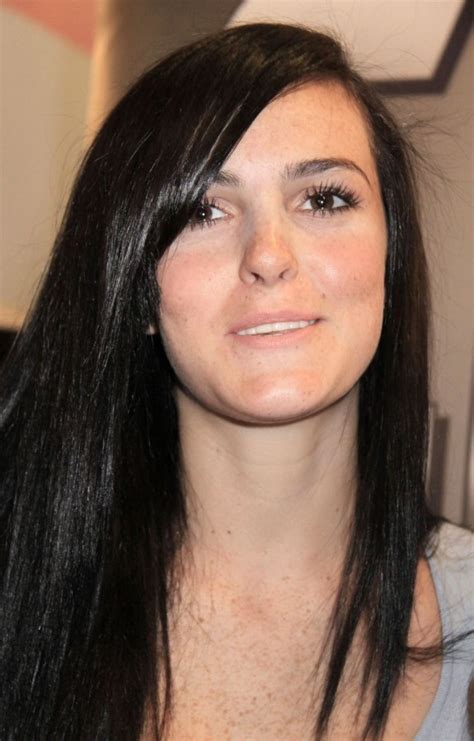 Ali Lohan Before Plastic Surgery 1315 Celebrity Plastic Surgery Online