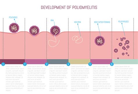 Infographic On Polio Disease Polio Reproduction Process Celebration Of