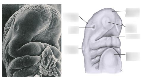 Diagram Of 4 Week Embryo Scanning Electron Micrograph Quizlet