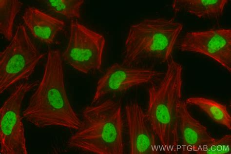 Acetyl Histone H2b Lys5 Antibody Cl488 83171 4 Proteintech
