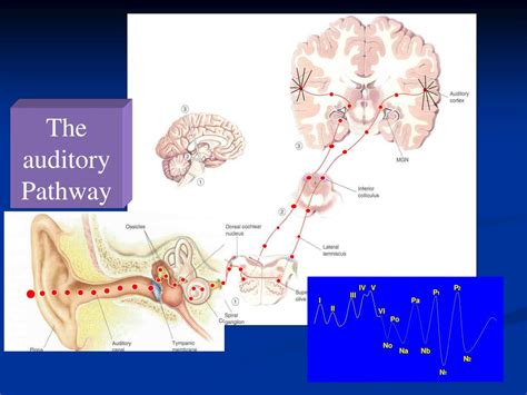 Ppt Aep Monitor Auditory Evoked Potential Powerpoint