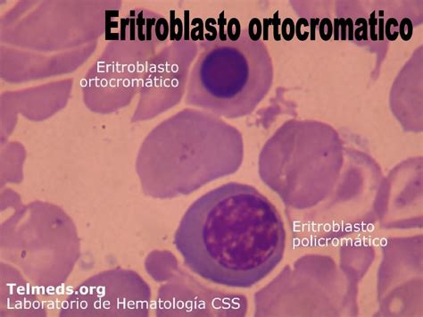 Eritropoyesis