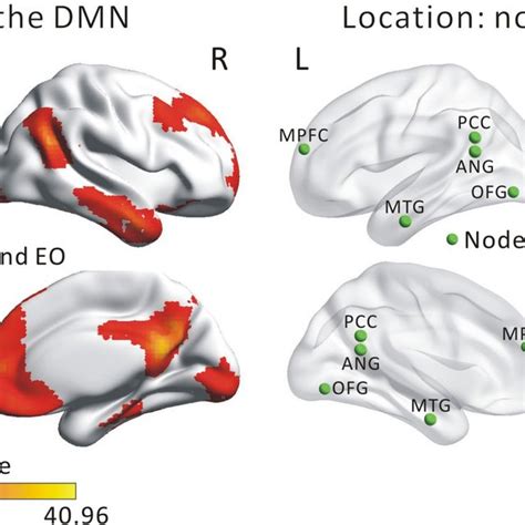 Spatial Distribution Of Temporal Correlations For The Posterior