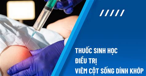 11 Thuốc Sinh Học điều Trị Viêm Cột Sống Dính Khớp Hiệu Quả Hiện Nay
