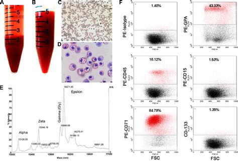 Large Scale Production Of Erythroid Cells From Hescs A Erythroid