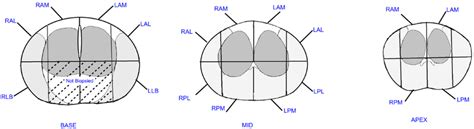 Ten Sector Template Lal Left Anterior Lateral Lam Left Anterior