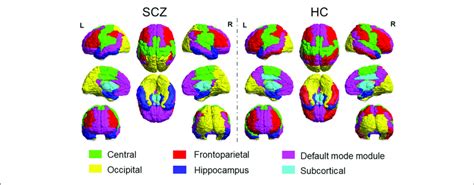 Modular Topology Of Functional Network In Schizophrenia Left And Download Scientific