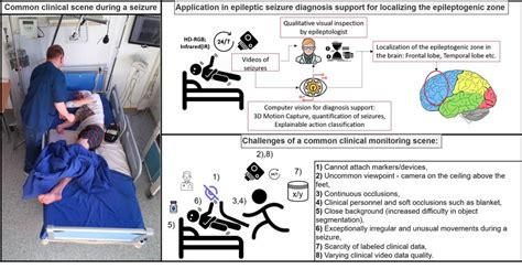 A Complex Application Of In Bed Movement Action Recognition