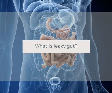 Leaky Gut Syndrome Also Known As Intestinal Permeability By Dr Marie