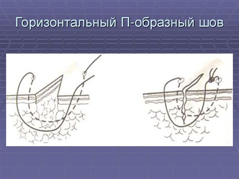 Введение в курс оперативной хирургии и топографической анатомии
