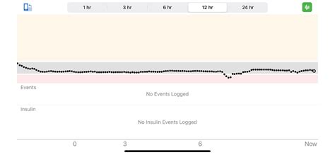 Dexcom Data R Type1diabetes