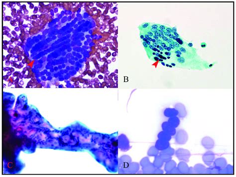 Nuclear Arrangements Complex Patterns Of Syncytiotrophoblast Nuclear