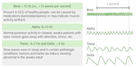 Epilepsy Concise Medical Knowledge