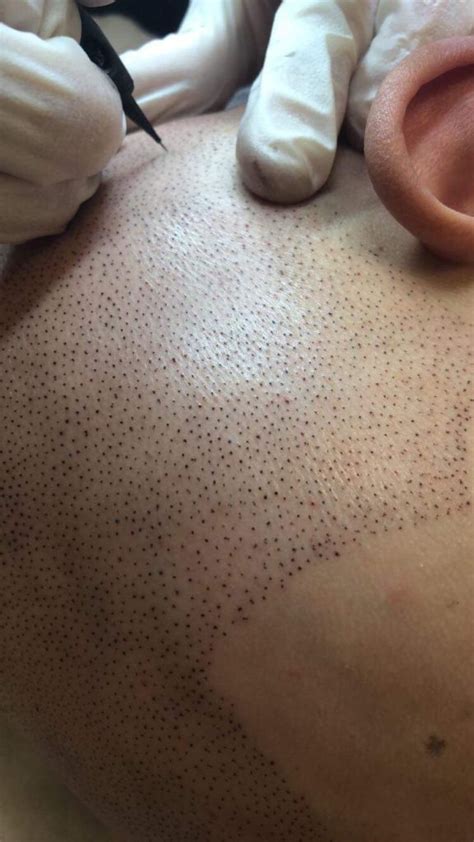 Scalp Tatoo Skincare By Anki