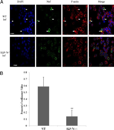 Nef F Actin Association Is Attenuated In Hiv 1 Infected Slp 76 22