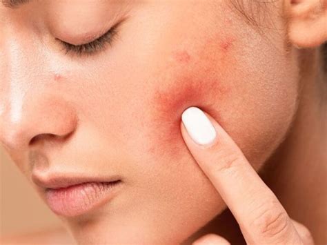 Jenis Jenis Bopeng Yang Tidak Boleh Di Sepelekan