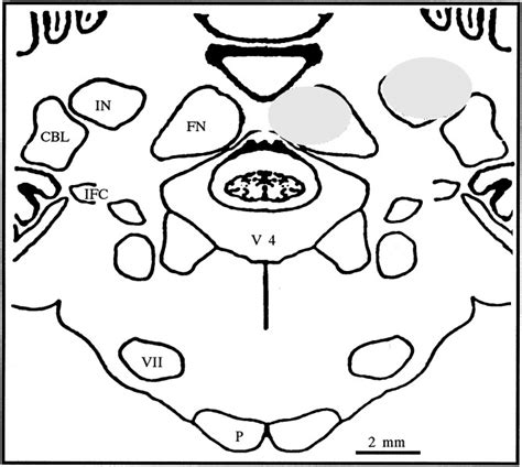 Schematic Histological Section Showing Areas Lesioned By Thermal Probe Download Scientific