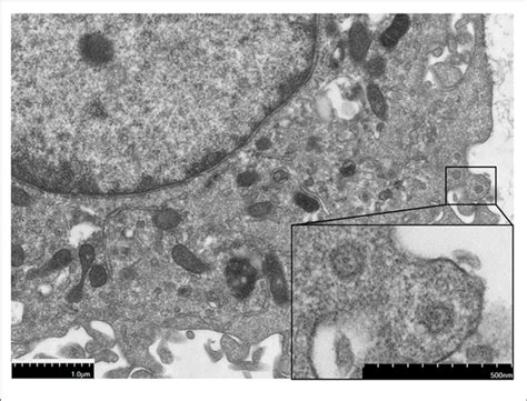 The Electron Micrographs Of Virus Particles The Section Of The