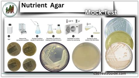 Urine Urobilinogen Purpose Procedure And Interpretation Of Results