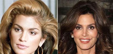 Cindy Crawford Plastic Surgery Before And After Botox And Nose Jobs