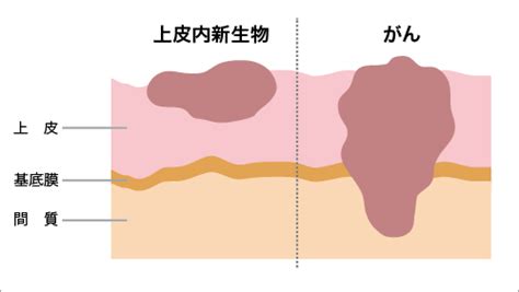 Zono Town