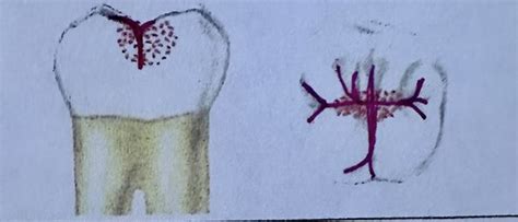 Classification Location And Description Of Tooth Decay Flashcards Quizlet