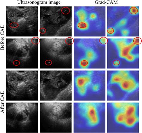 convolutional neural network visualization of ultrasound images via a