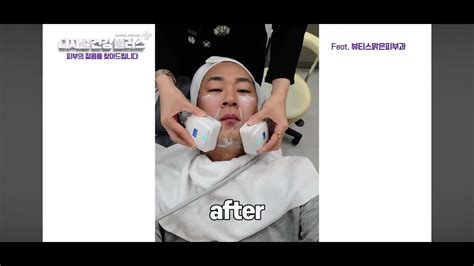 디지털건강플러스3｜최신 레이저 장비로 직접 받아본 탄력 치료 심술보레이저 네오스컬프 Youtube