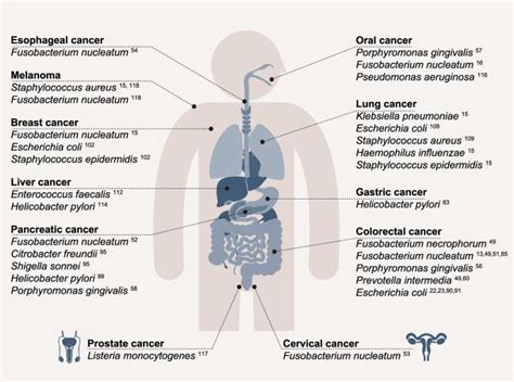 Laura Pozzi Ph D On Linkedin Intracellular Bacteria In Cancer
