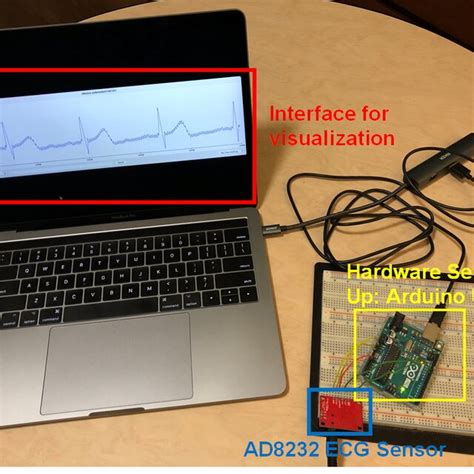 Hardware Setup And The Approach Used To Record The Ecg And Generate