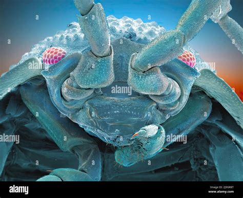 Lice Under Microscope