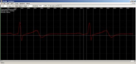 xoscillo shows your heartbeat wave ecg showcase arduino forum