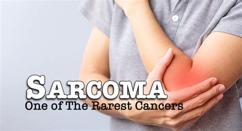 10 Quick Facts About Sarcoma One Of The Rarest Cancers Mega Doctor News