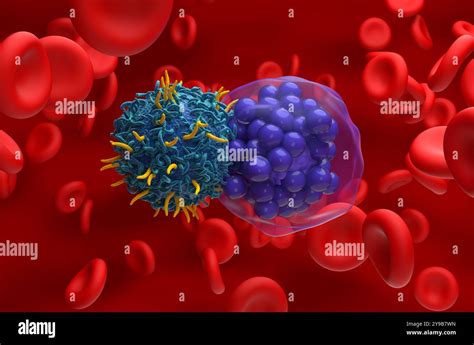 Car T Cell Therapy In Diffuse Large B Cell Lymphoma Dlbcl Closeup
