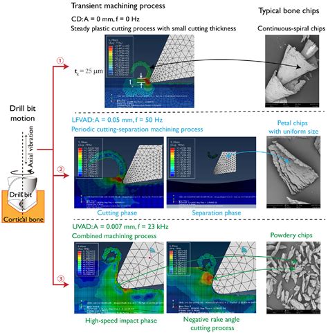 Investigation Of Transient Machining In The Cortical Bone Drilling