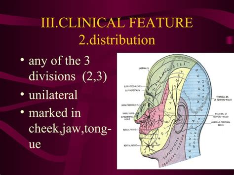 Primary Trigeminal Neuralgia Ppt