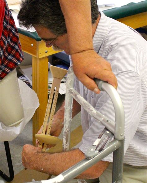 Farmer John Gets A New State Of The Art Prosthetic Leg Greenwich