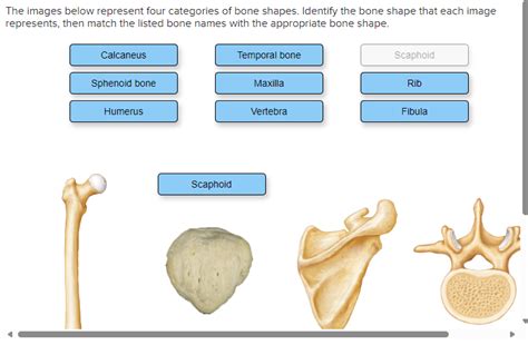 solved the images below represent four categories of bone