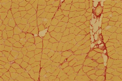 Picture Of The Month Microstructure Of Skeletal Muscle The Key To Understanding Our Bodys