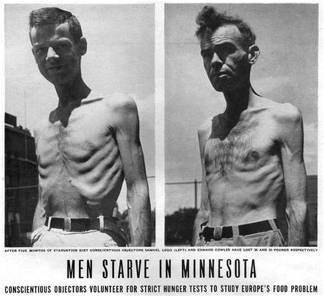 Symptoms Of Starvation New Health Advisor