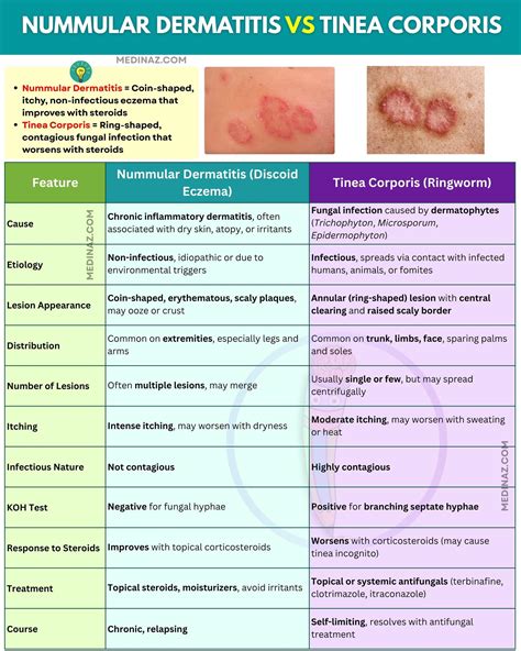 Medinaz Nummular Dermatitis Vs Tenia Corporis Facebook