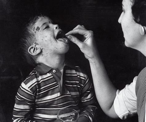 What Happened After The Chicken Pox Vaccine The New Yorker